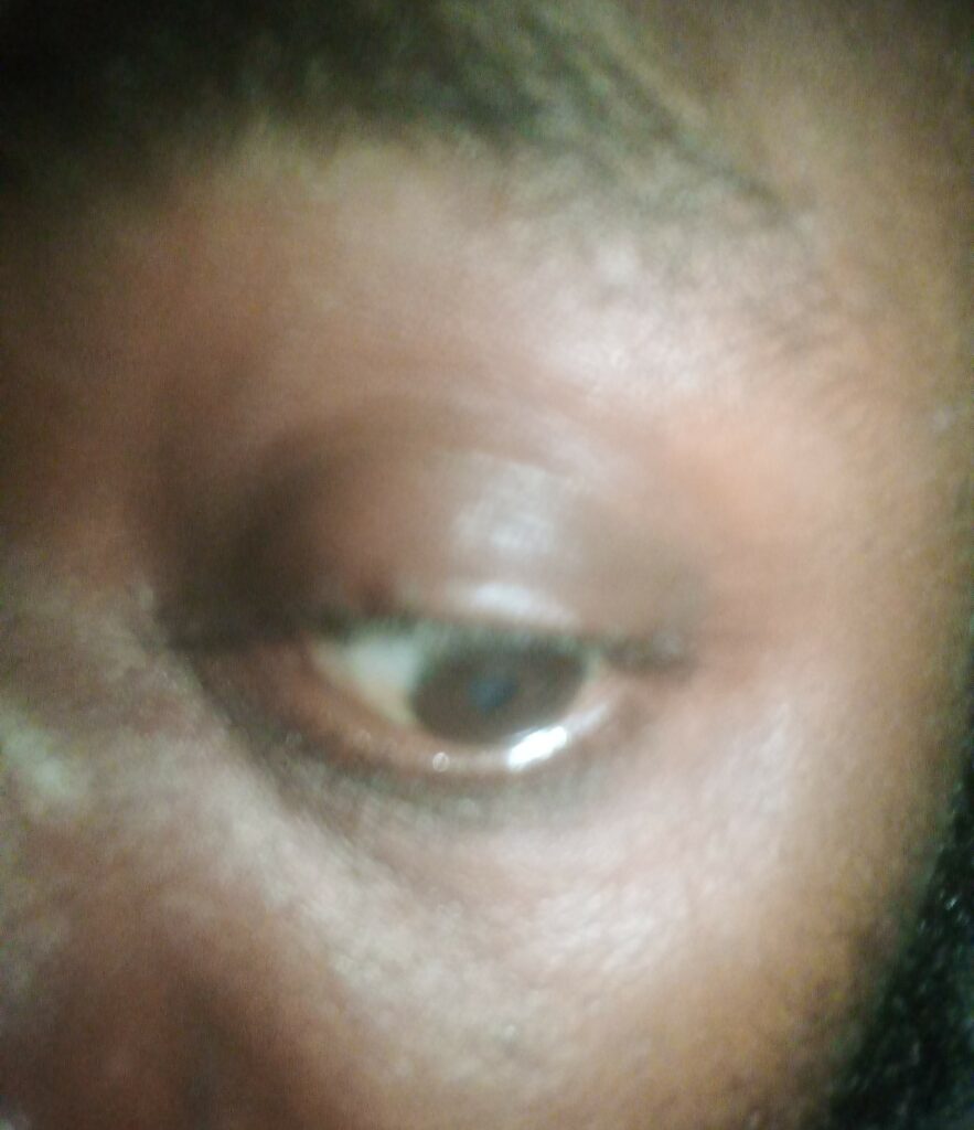 Rivers State: Expert Blames Soot For Swollen Itchy Eyes of Residents ...